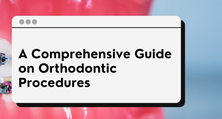 A Comprehensive Guide on Orthodontic Procedures - The Singaporean