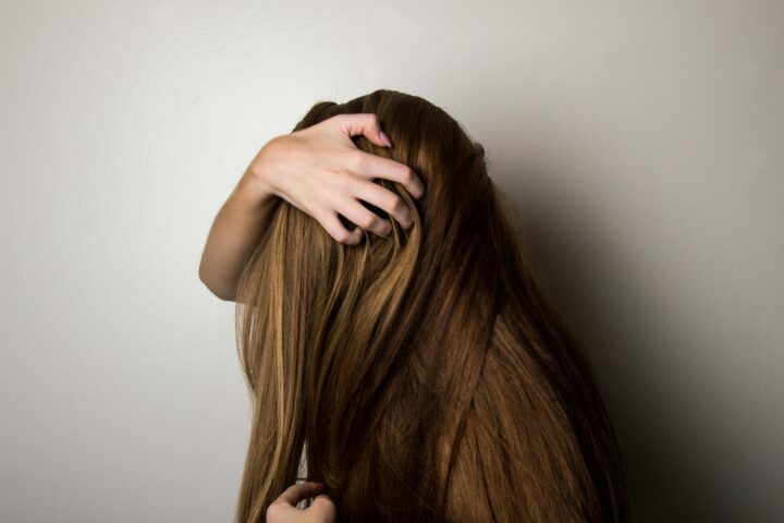 11 Best Hair Loss Treatment Clinics in Singapore for Effective Results ...